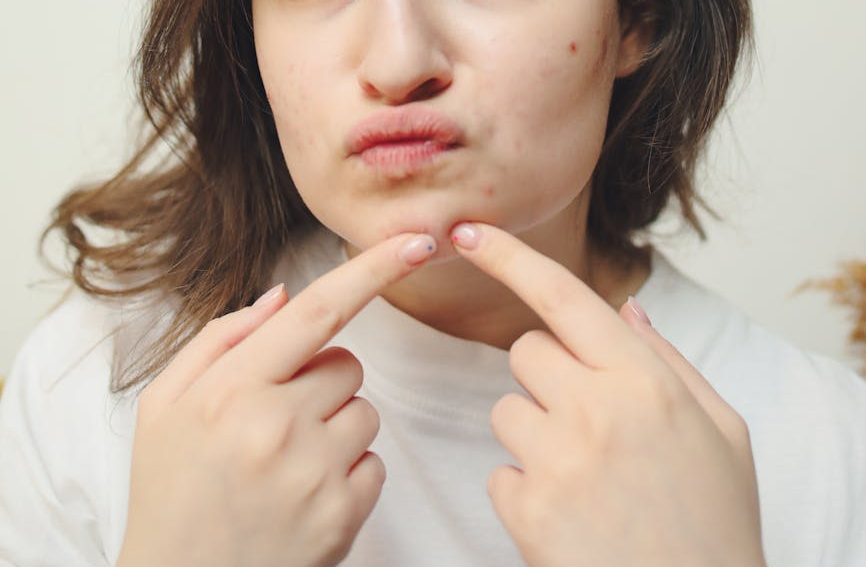 Hey, Face Pickers: Here’s What You Need To Know