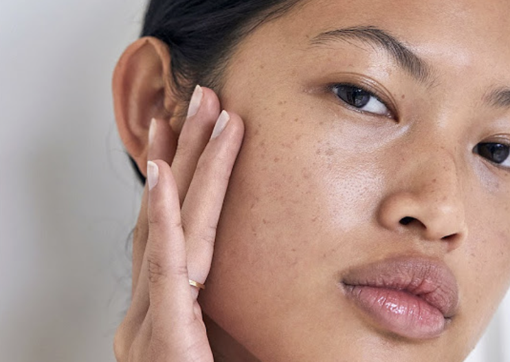 Skinimalism: The Trend Taking Over Millennial Skincare - Millennial Skin