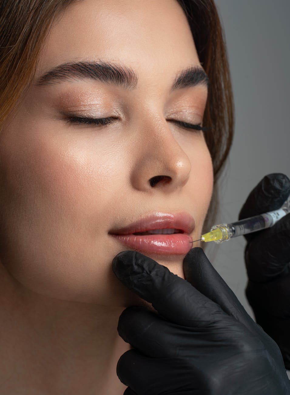 Aesthetic Fillers to Surge to $8.45B by 2033 - Millennial Skin